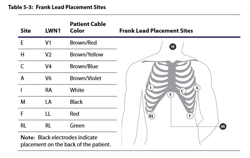  DIAGRAM Ecg Lead Placement Guide Diagram MYDIAGRAM ONLINE