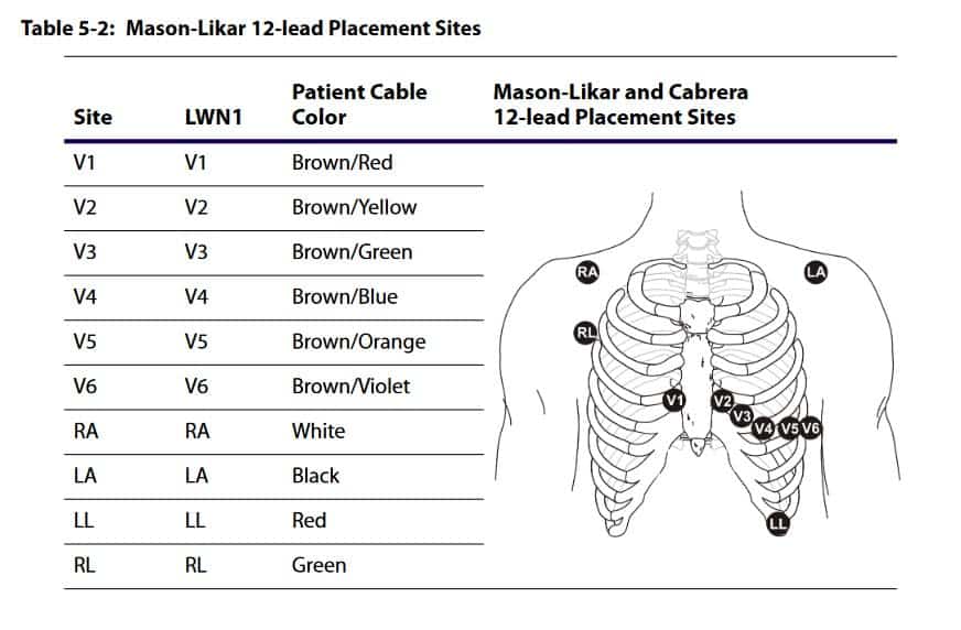 12 Lead EKG Placement Chart