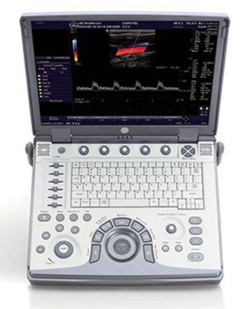 Buy GE Logiq E Portable Ultrasound Machine Online | Aimcardio