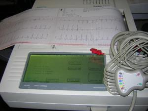Burdick E350 EKG